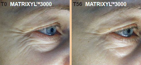 Bellahut MATRIXYL 3000™ by Bellahut With Matrixyl 3000™